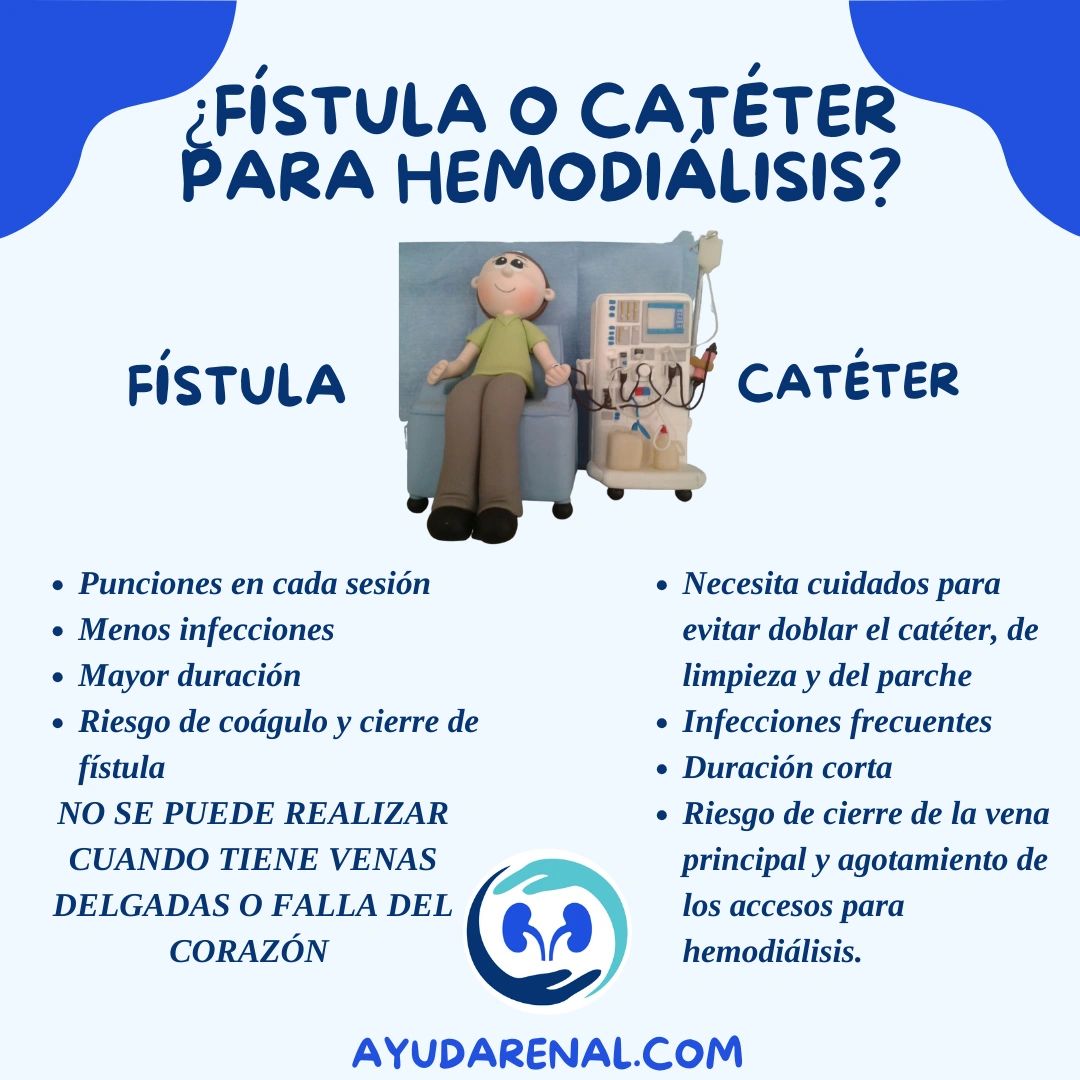 ¿Fístula o catéter para hemodiálisis?