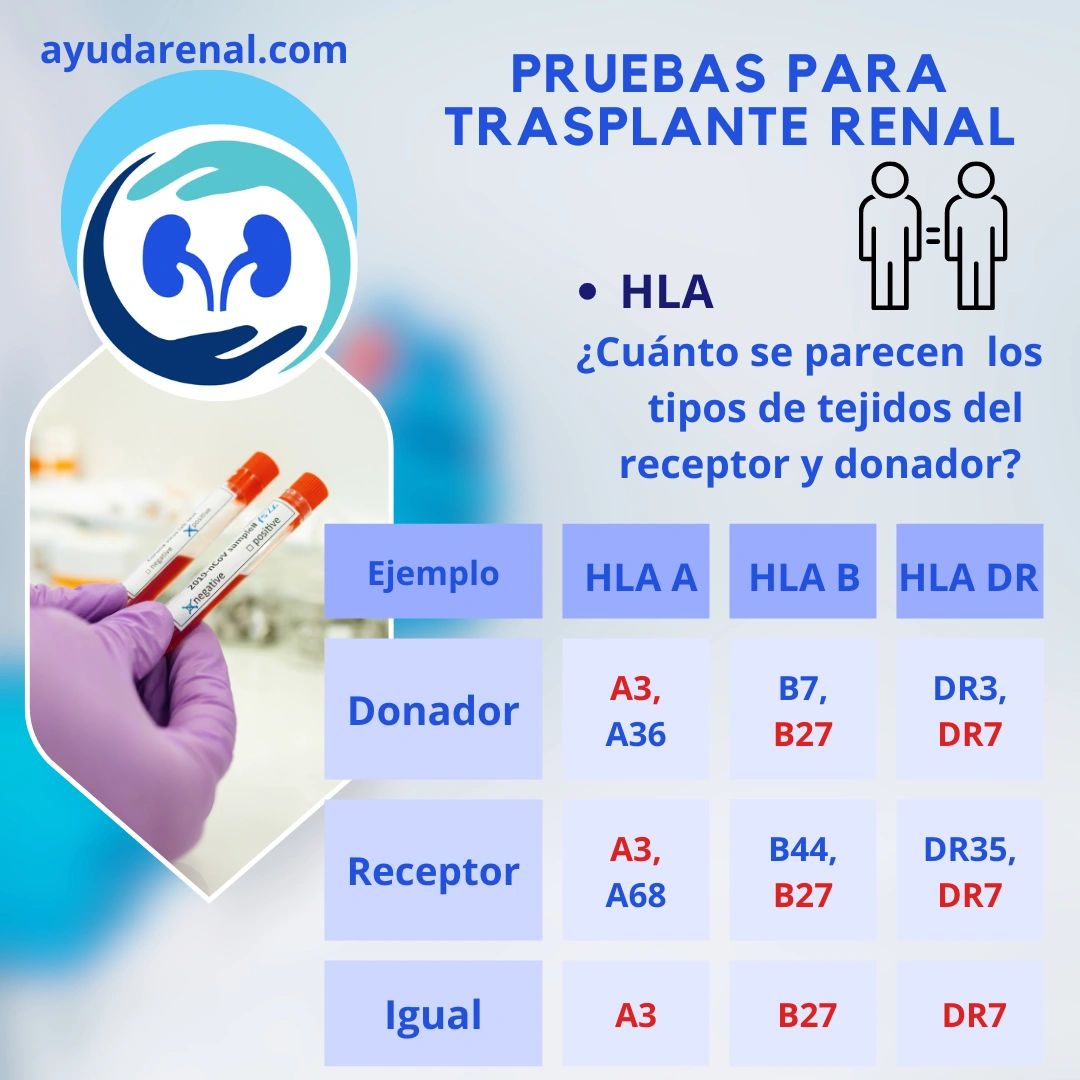 Prueba de HLA