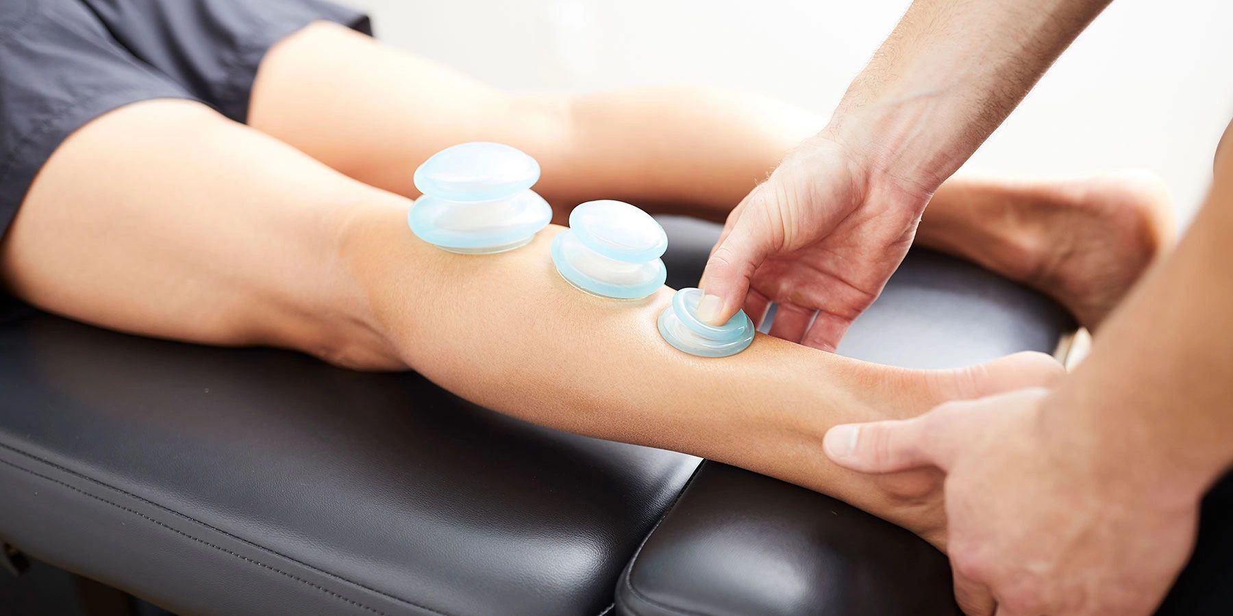 Running Tips: Cupping