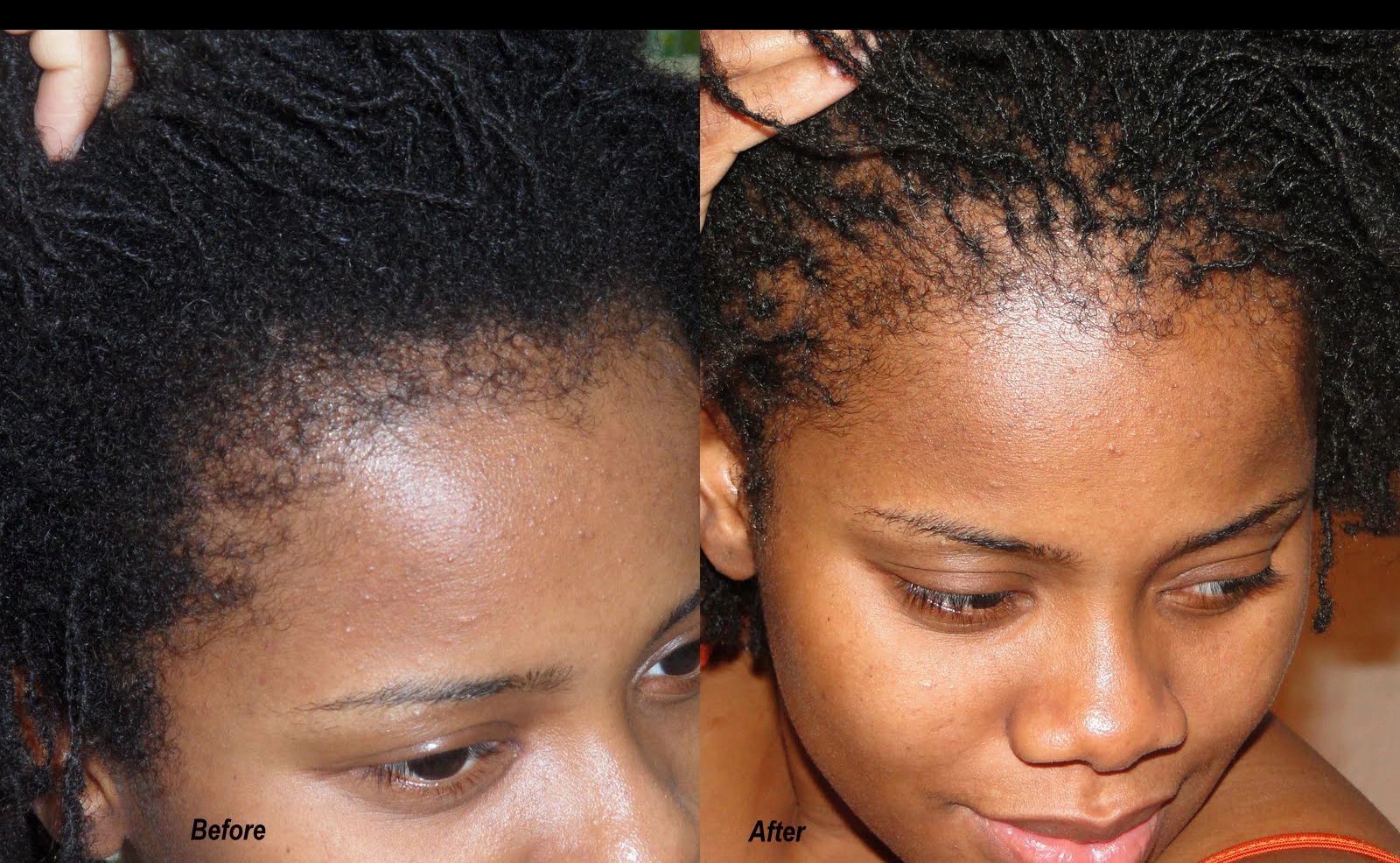 Loc Interlock Retightening