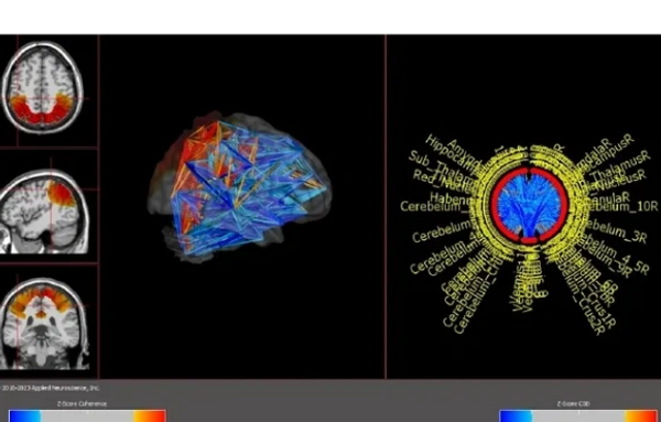 Concussion TBI Neurodiagnostic Laboratory - Houston, Texas