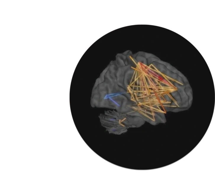 Concussion TBI Neurodiagnostic Laboratory - Houston, Texas