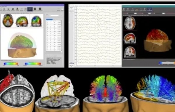 Concussion TBI Neurodiagnostic Laboratory - Houston, Texas