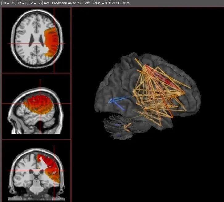 Concussion TBI Neurodiagnostic Laboratory - Houston, Texas