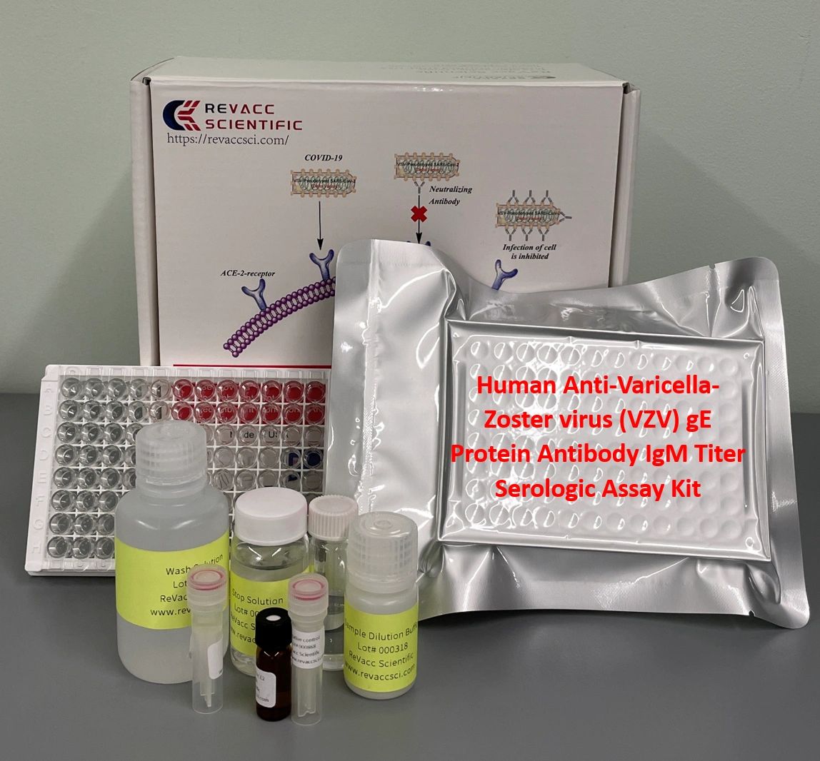 Human Anti-Varicella-Zoster virus (VZV) gE Protein Antibody IgM Titer ...