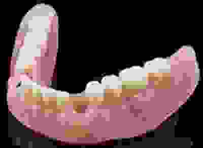 Full Service Dental Lab - Slay Dental | Slay Dental