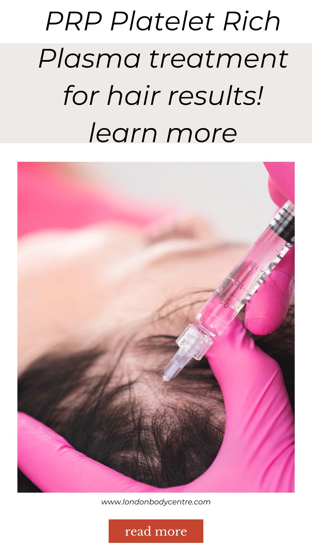 PRP Platelet Rich Plasma treatment for hair results learn more