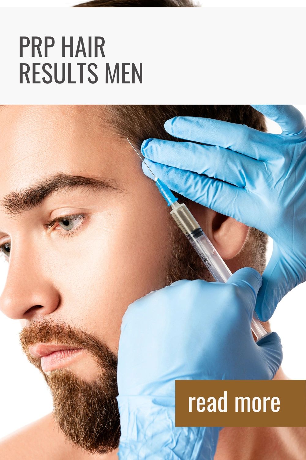 PRP hair results in men