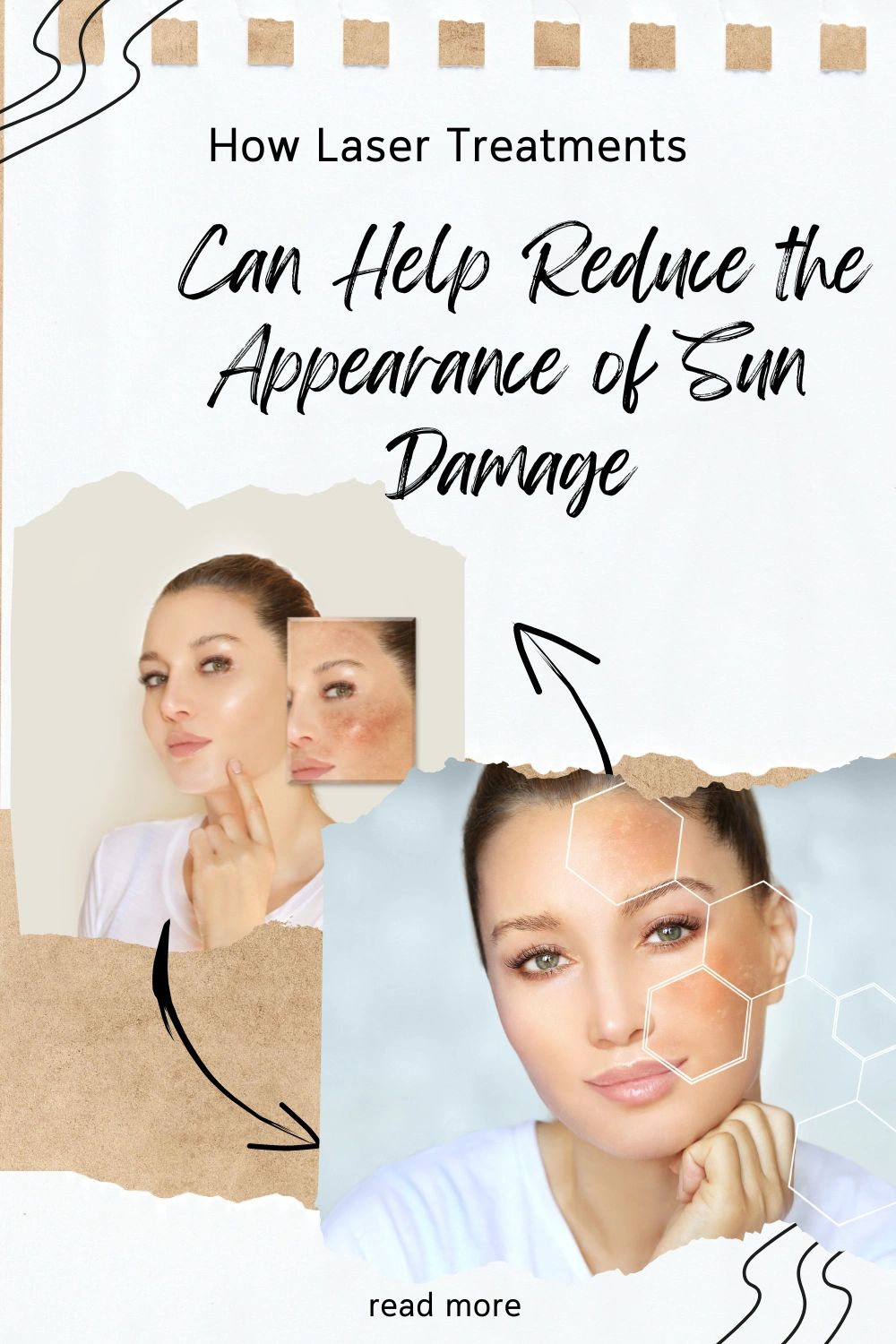 How Laser Treatments Can Help Reduce the Appearance of Sun Damage