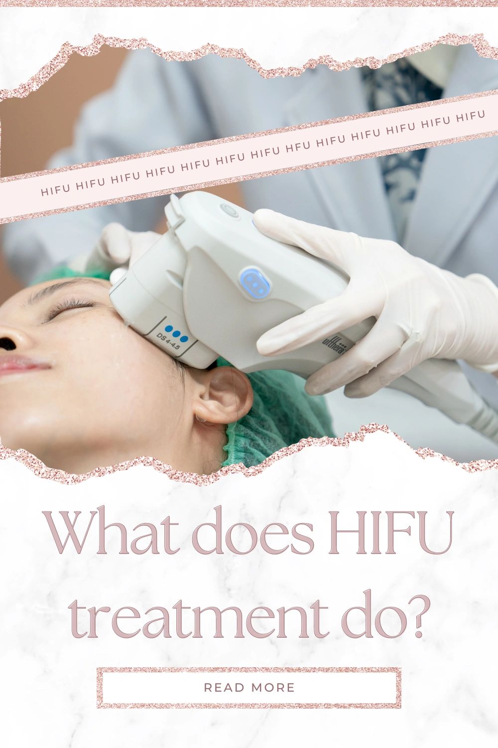 What does HIFU facial treatment actually do?
