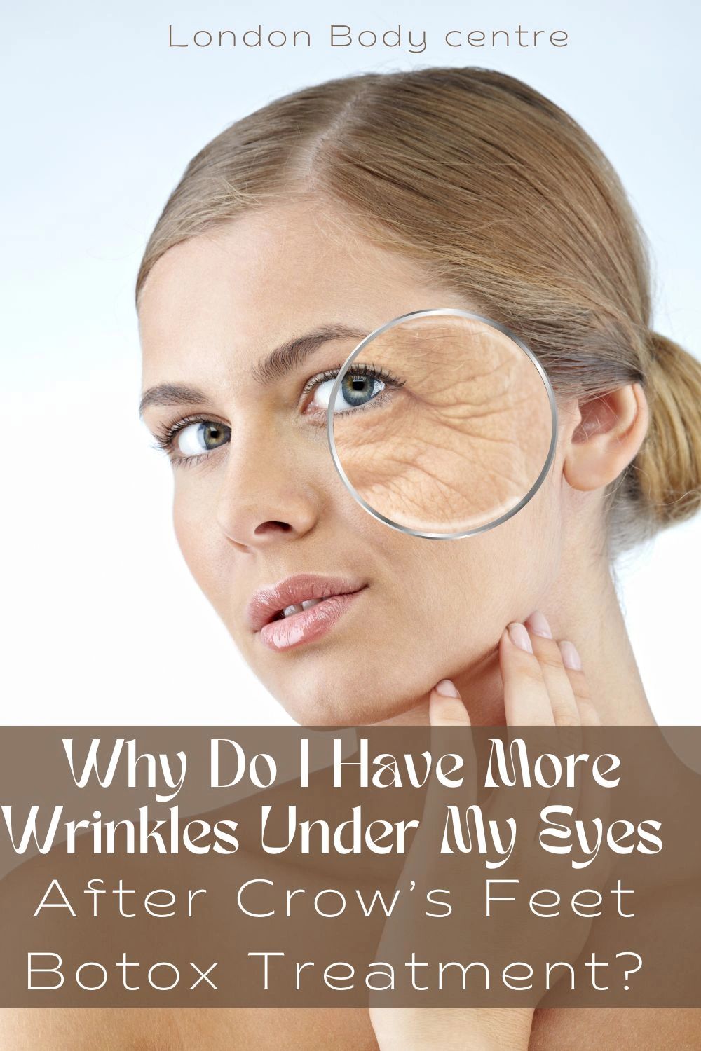 Why Do I Have More Wrinkles Under My Eyes After Crow’s Feet Botox