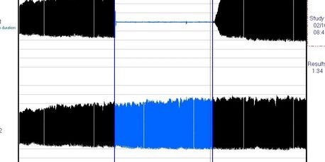 Endopat | Stephanie Cave MD