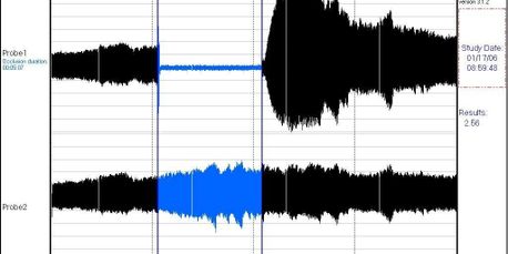 Endopat | Stephanie Cave MD