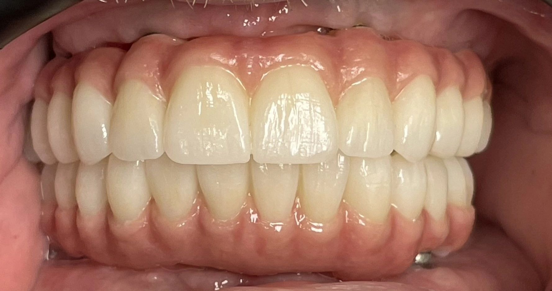 Elite Denture Solutions