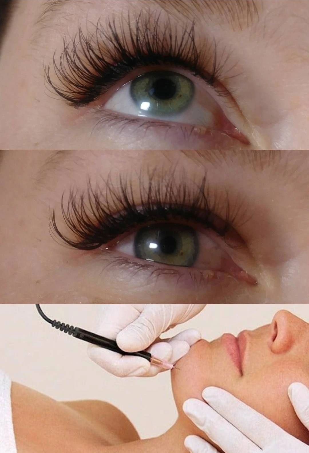 Home [electrolysisbyanat.com]