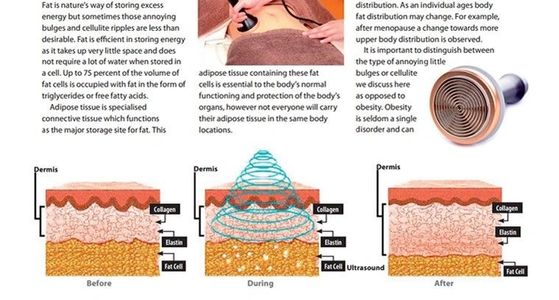 Ultrasound Cavitation | Deva's The Beauty Shop