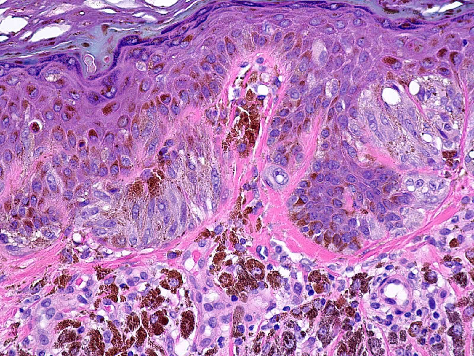 Derm Path Diagnostics: Expert Skin Disease Diagnosis