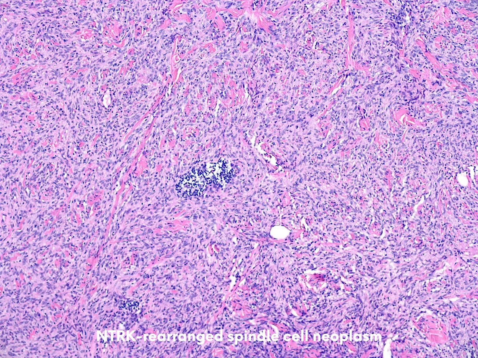 Derm Path Diagnostics: Expert Skin Disease Diagnosis