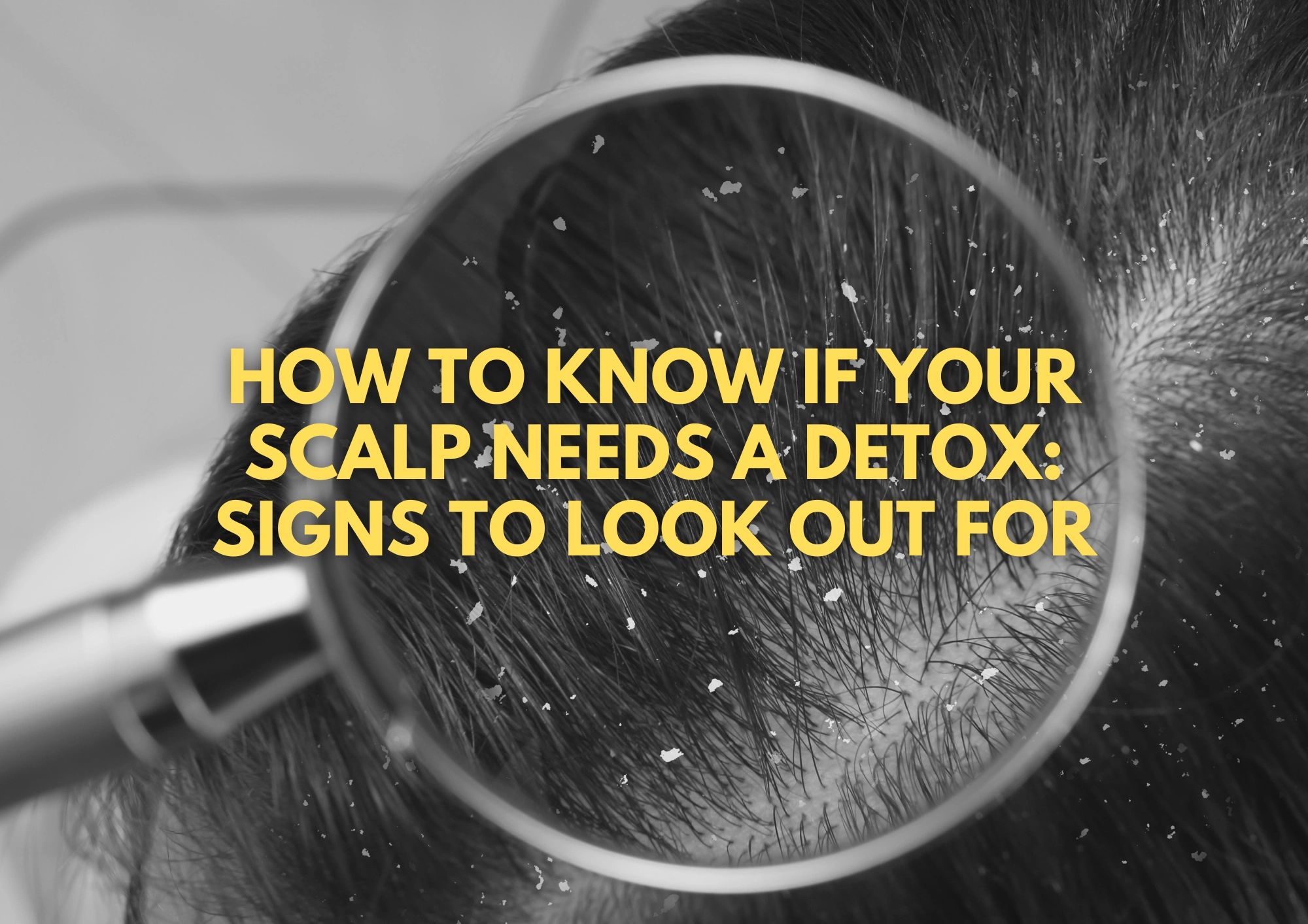 How to Know If Your Scalp Needs a Detox: Signs to Look Out For