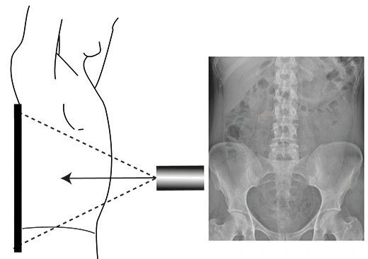 X-RAY ABDOMEN AP(SUPINE /ERECT) TEST IN DELHI, HAUZ KHAS X-RAY ABDOMEN AP(SUPINE /ERECT) TEST IN DELHI, HAUZ KHAS