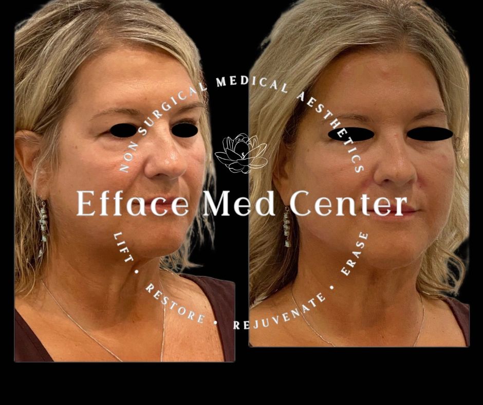 Unlock Your Aesthetic Potential with Dr. Ferrina Sheth, PA-C