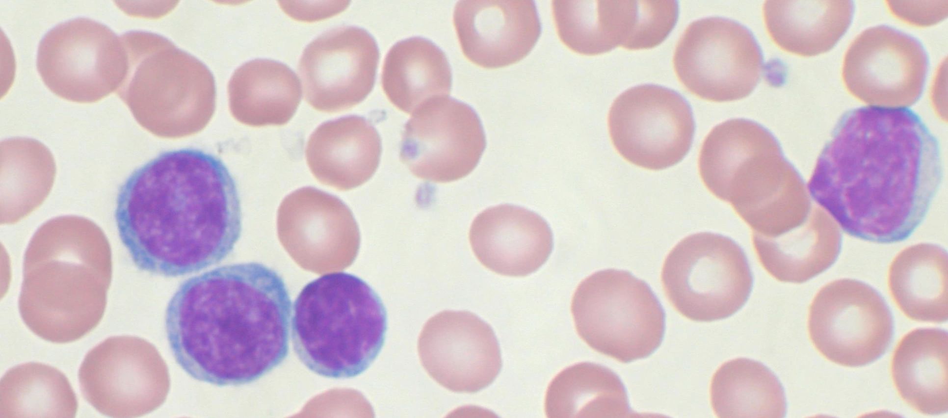 The Team | Cordyceps and CLL