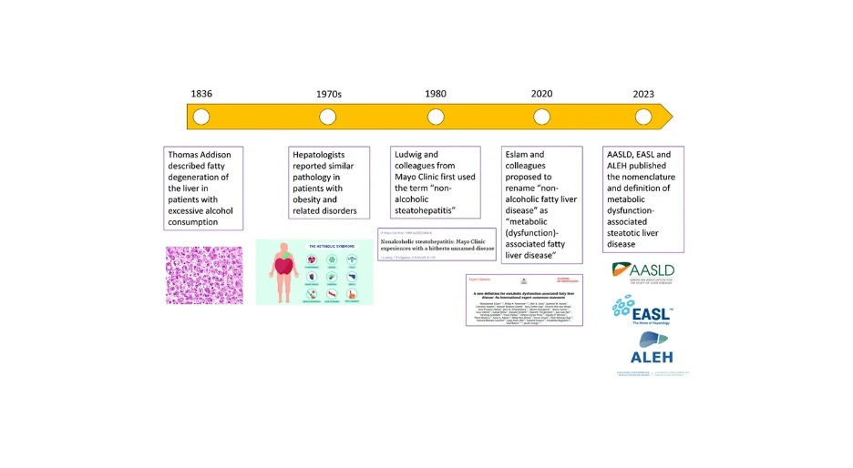 Effective Solutions for Fatty Liver Treatment