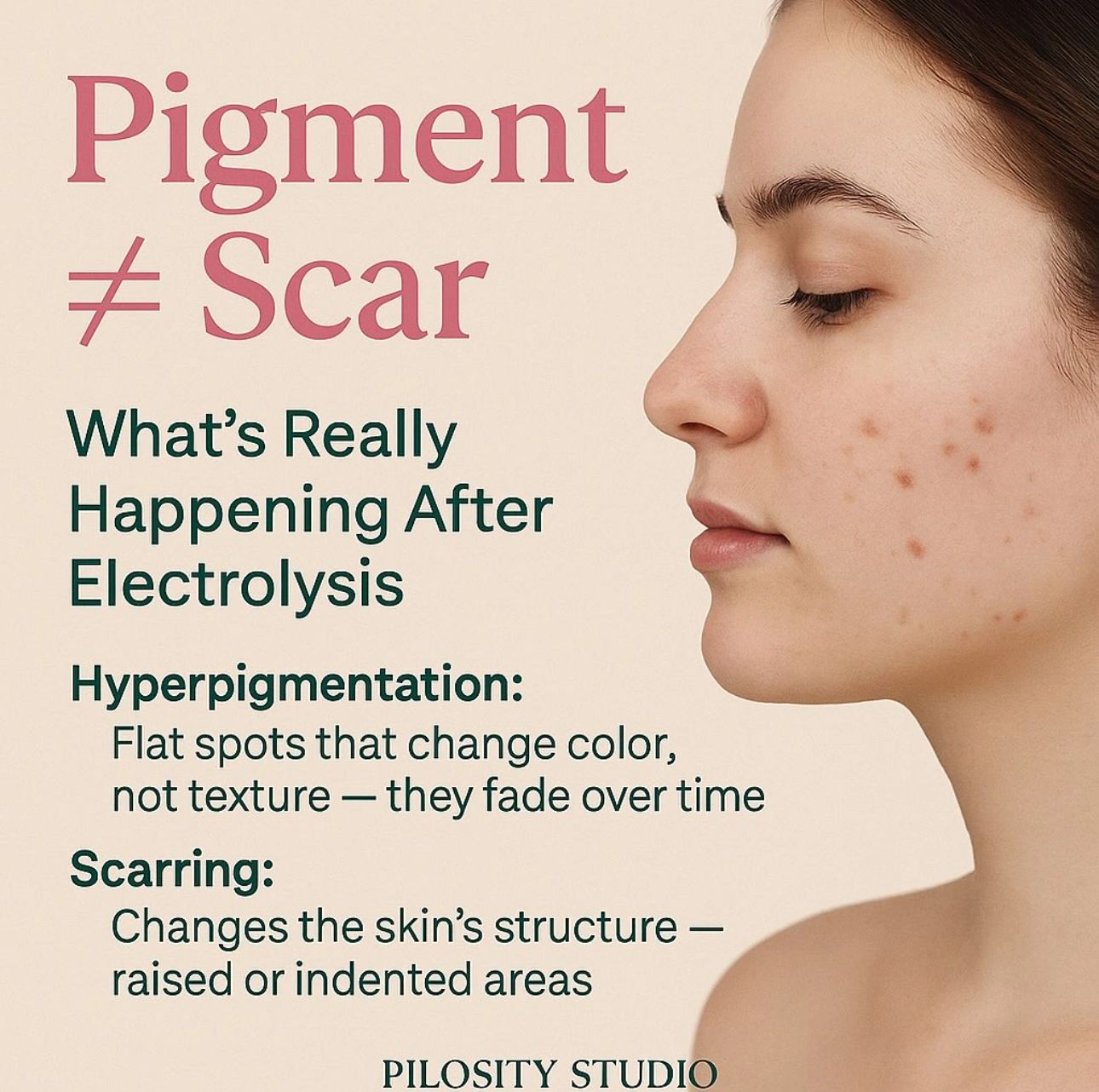 Understanding Skin Changes After Electrolysis: Pigment vs. Scars