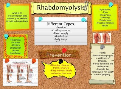 Rhabdomyolysis | WDC on Sickle Cell Trait
