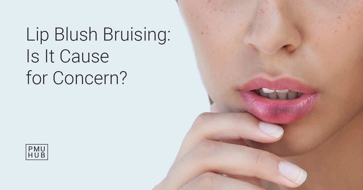 Bruising After Lip Blush – Is It Normal & How to Manage It?