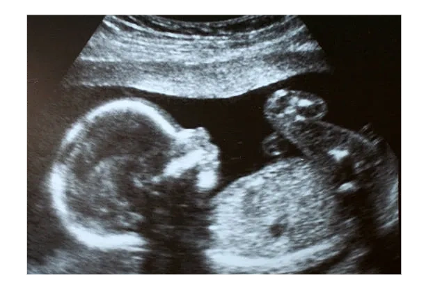 Early Ultrasound