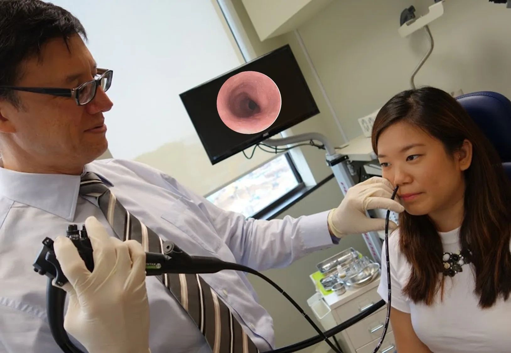 What is a transnasal gastroscopy