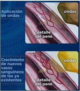 LO QUE NECESITAS SABER SOBRE LA DISFUNCION ERECTIL