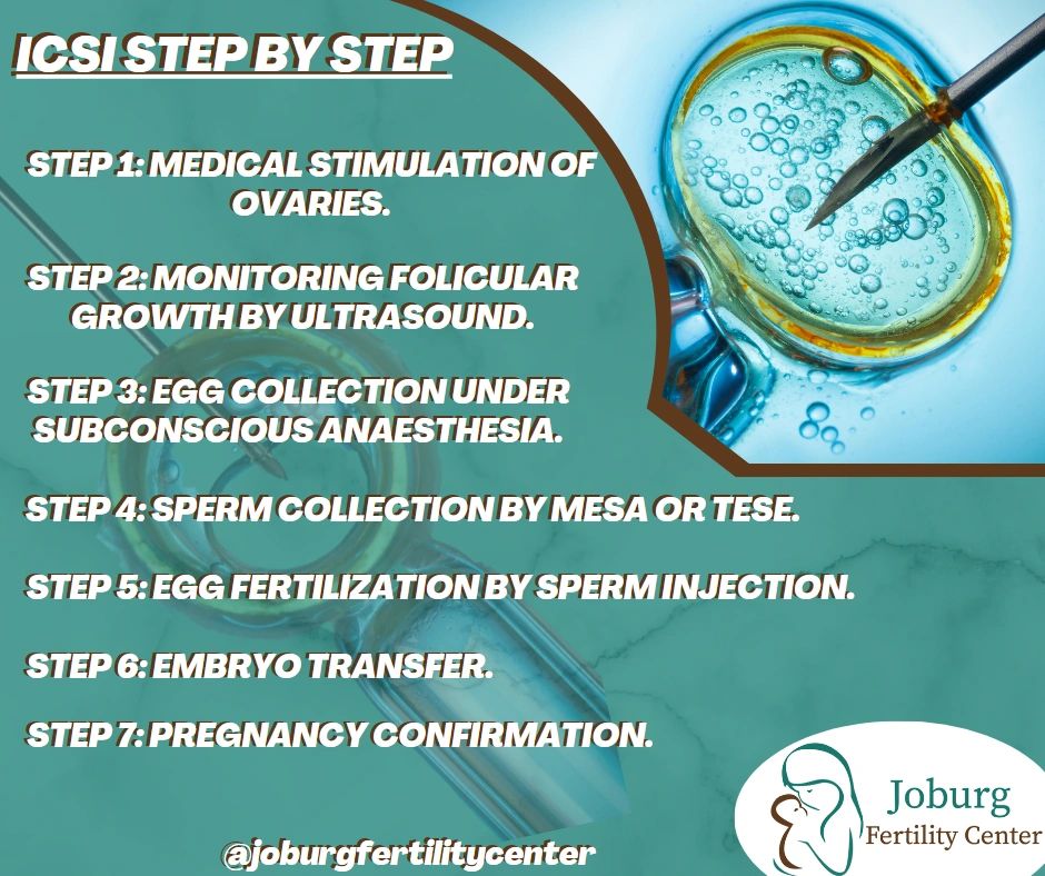 WHAT IS ICSI TREATMENT?