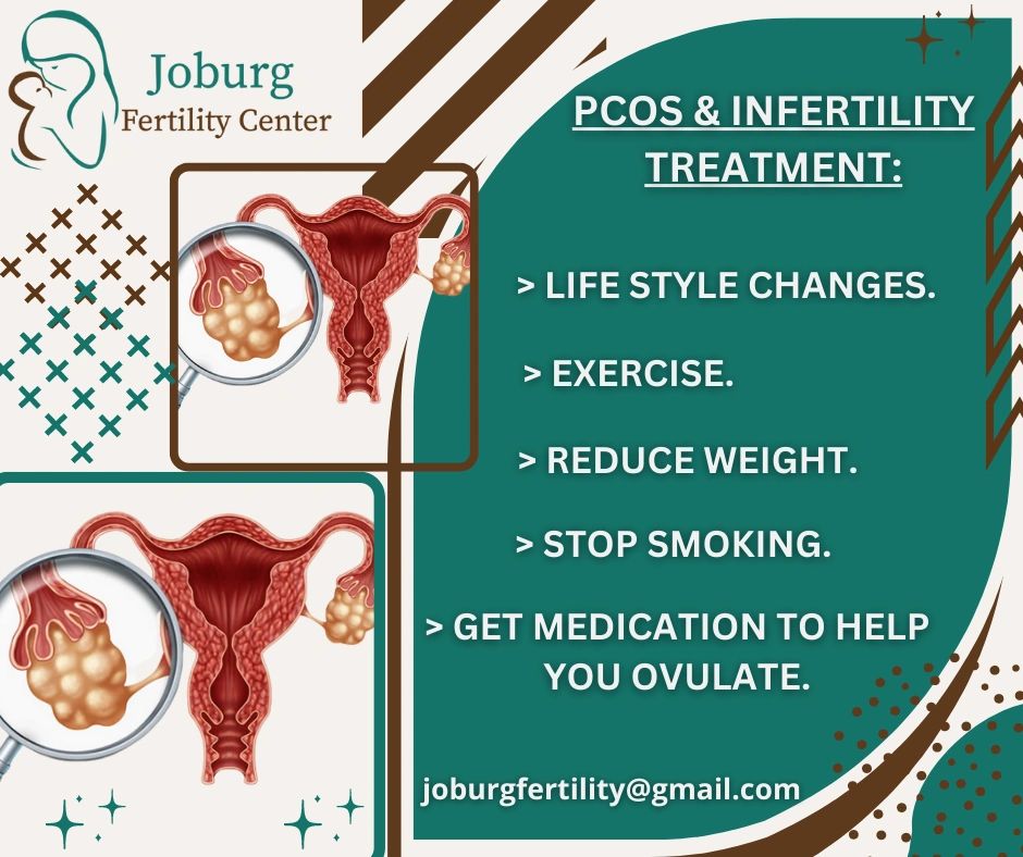 PCOS & Infertility.