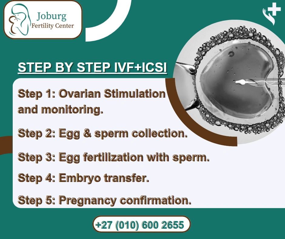 IVF / ICSI STEP BY STEP: