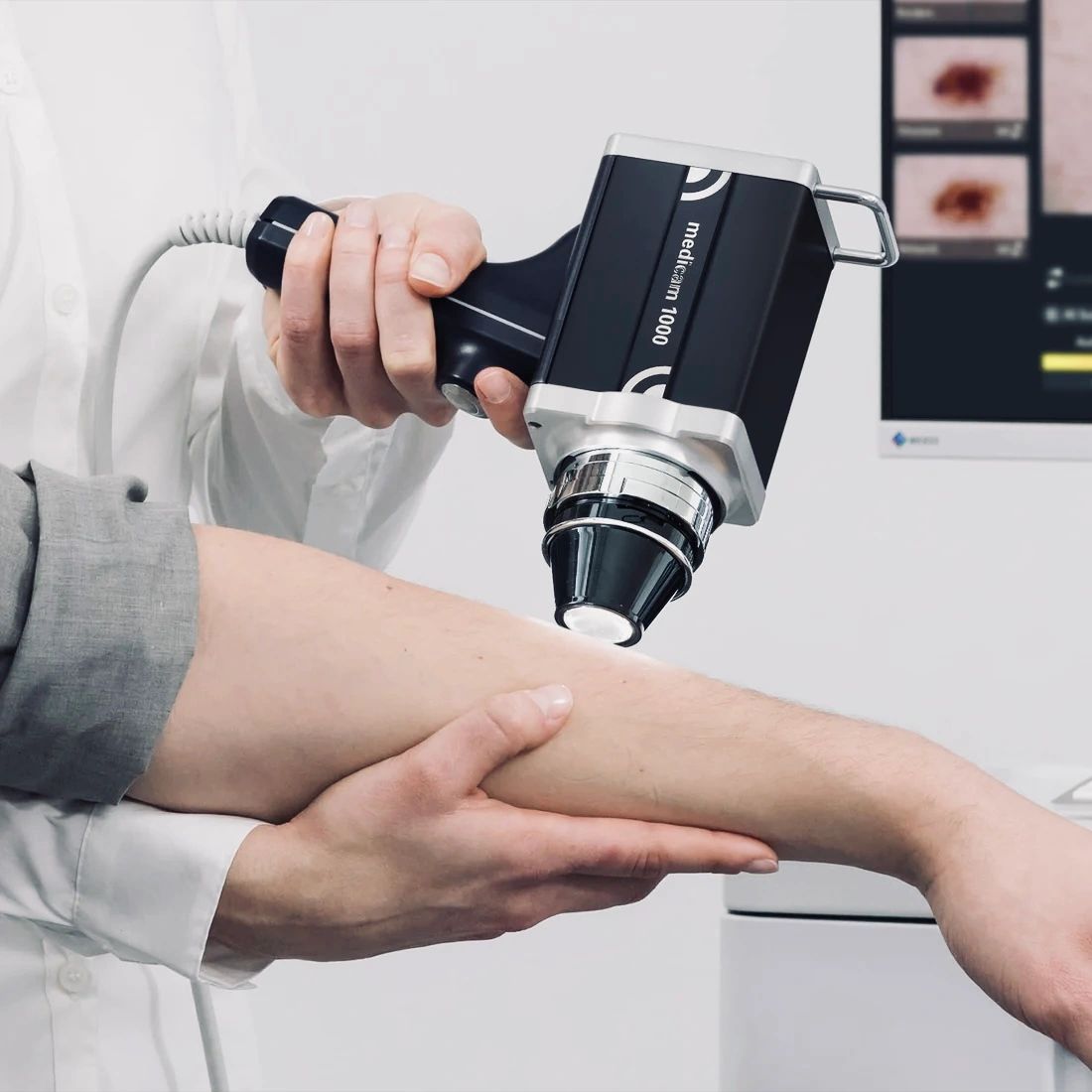 The Mole Mapping Clinic