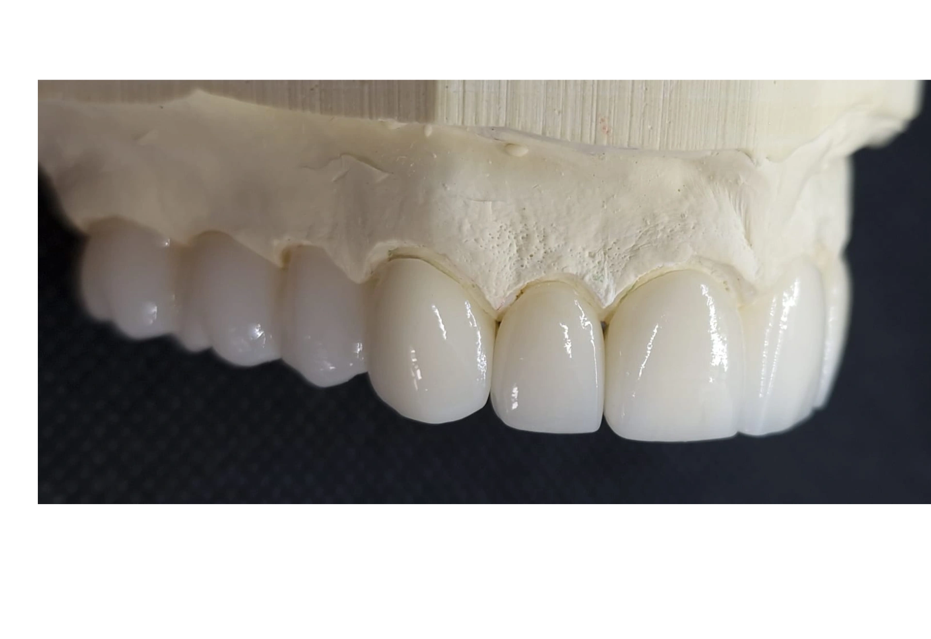 Dental Laboratory Services in the UK | IsoLab LTD