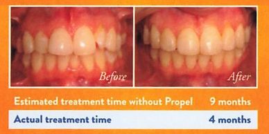 Dentist on Louetta Rd, Orthodontist, and Cosmetic Dentist in Spring, TX ...