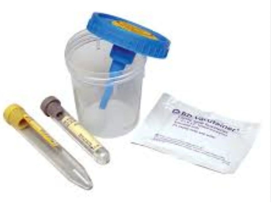 Routine -Random Urine Collection Services