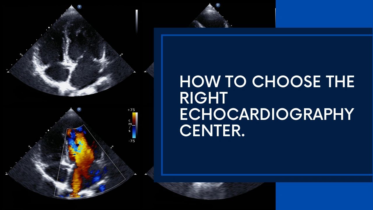 Choosing the Right Echocardiography Centre
