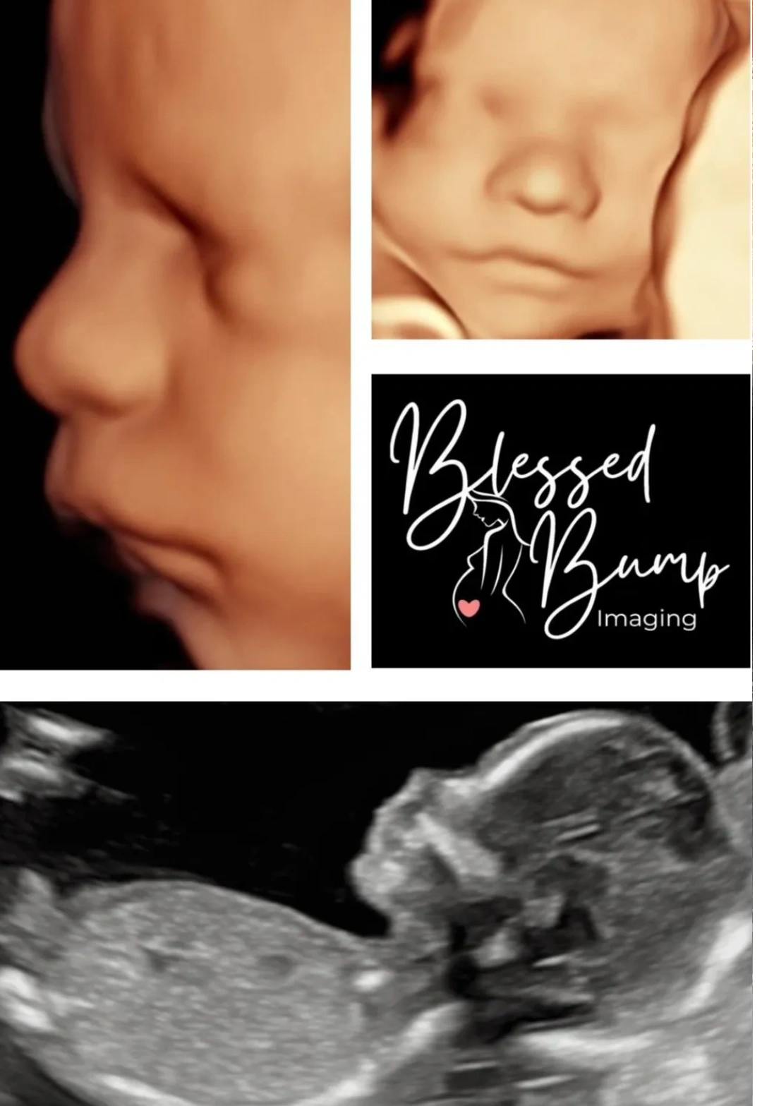Blessed Bump Imaging