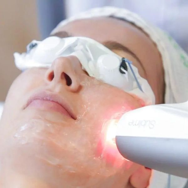 Laser Treatments