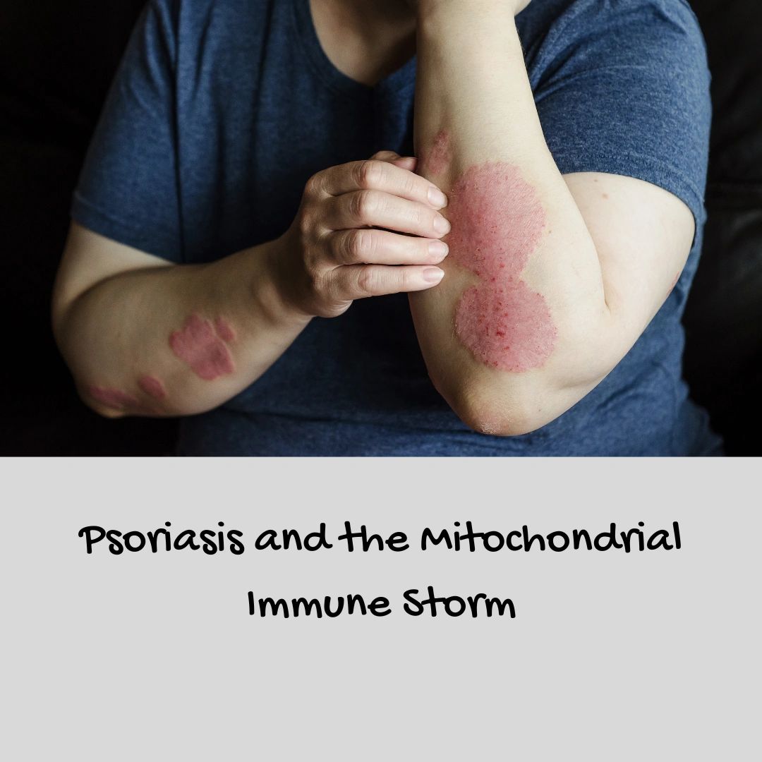 Psoriasis and the Mitochondrial Immune Storm: A New Root Cause
