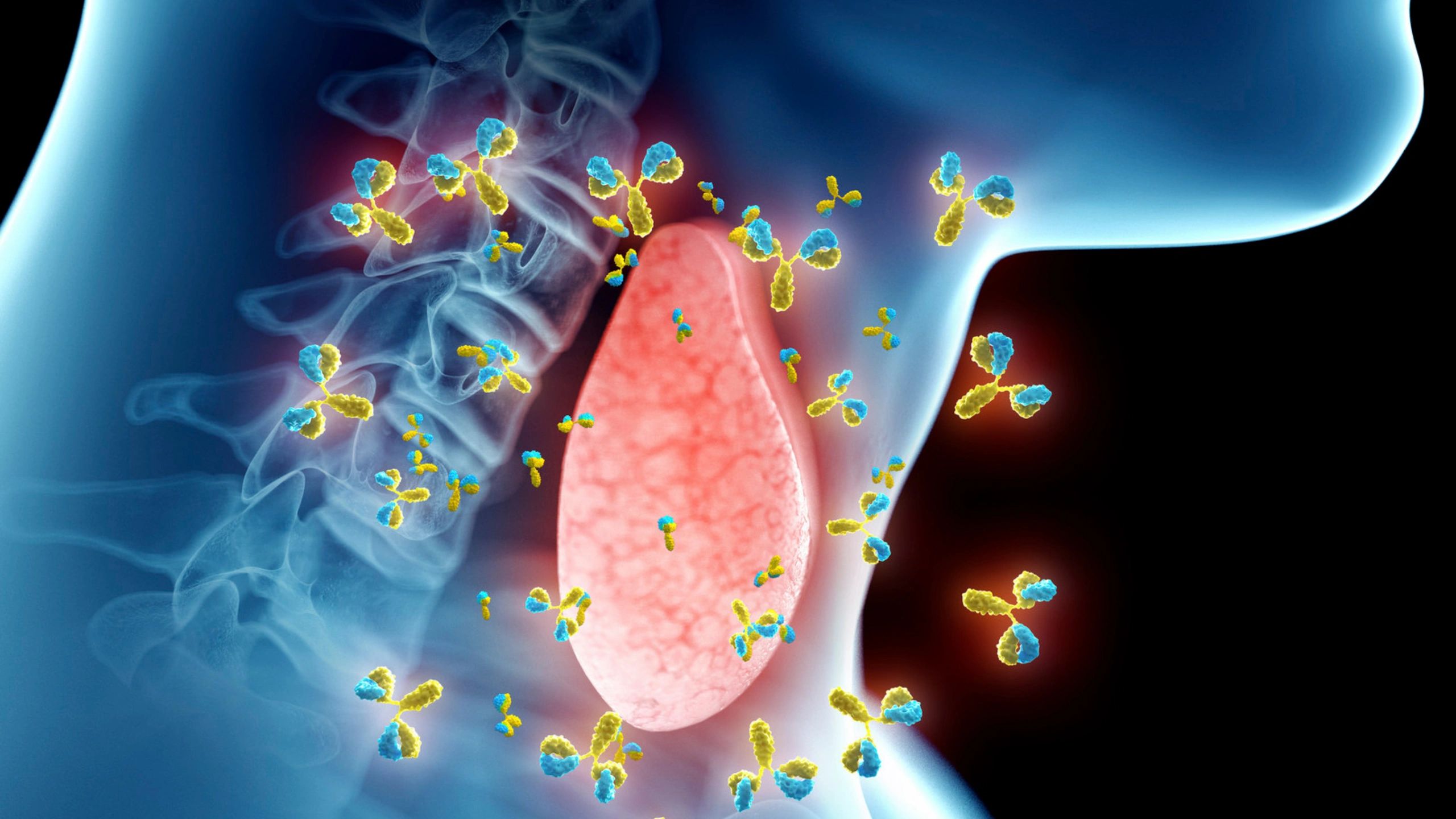 Thyroid Peroxidase Antibody: What Is It And What Does It Do?