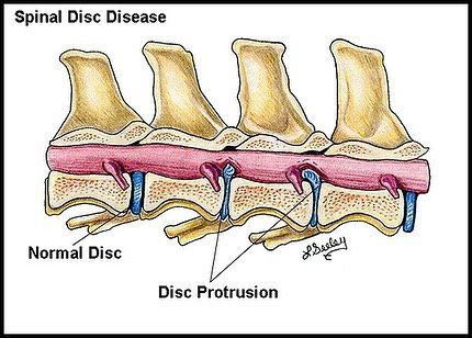 Agility injuries series- Intervertebral disc disease (IVDD)