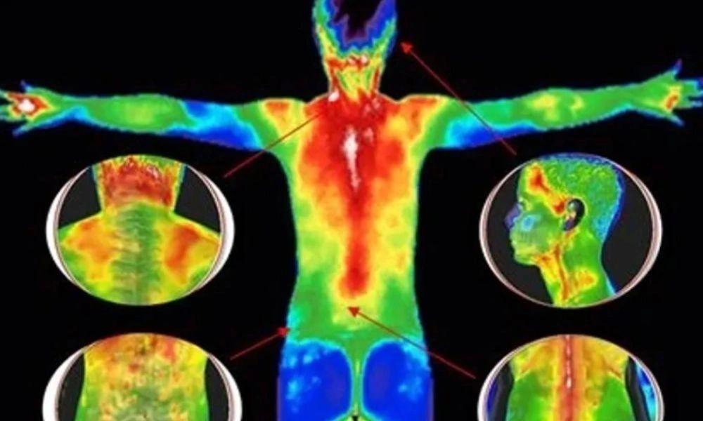 Termografia Médica na Medicina do esporte