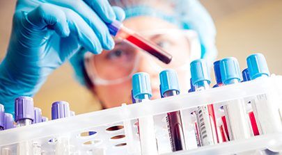 Proteína C-reativa (PCR): o que é e porque pode estar alta