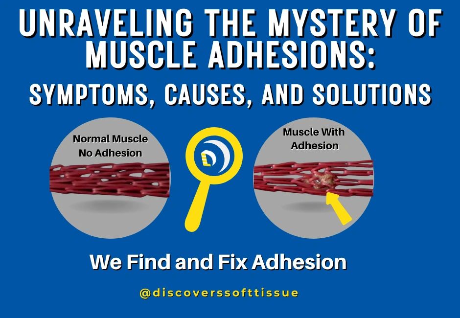 Muscle Adhesions Uncovered: Causes, Symptoms & Fixes