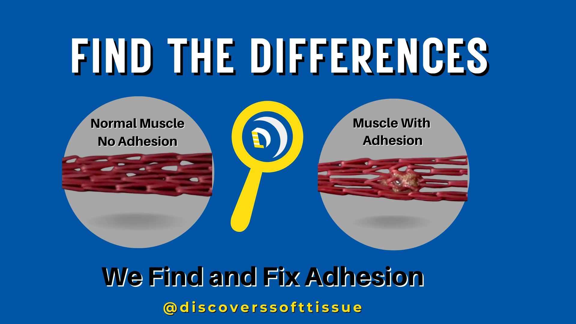 Fibrous Adhesion Awareness